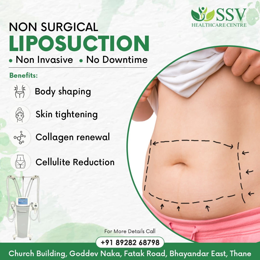 Non-Surgical Liposuction – SSV Healthcare Centre